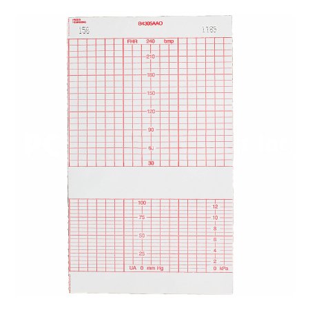 Fetal Diagnostic Monitor Recording Paper Life Trace® Thermal Paper 152 ...